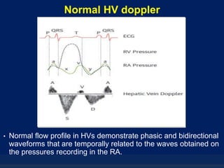 Hepatic veins - The Doppler interrogation | PPTX