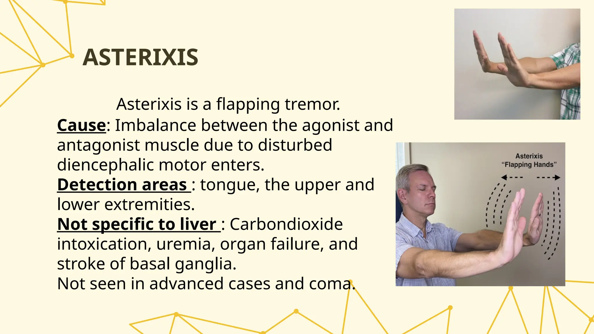 PEDIATRICS hepatitic encephalopathy.pptx