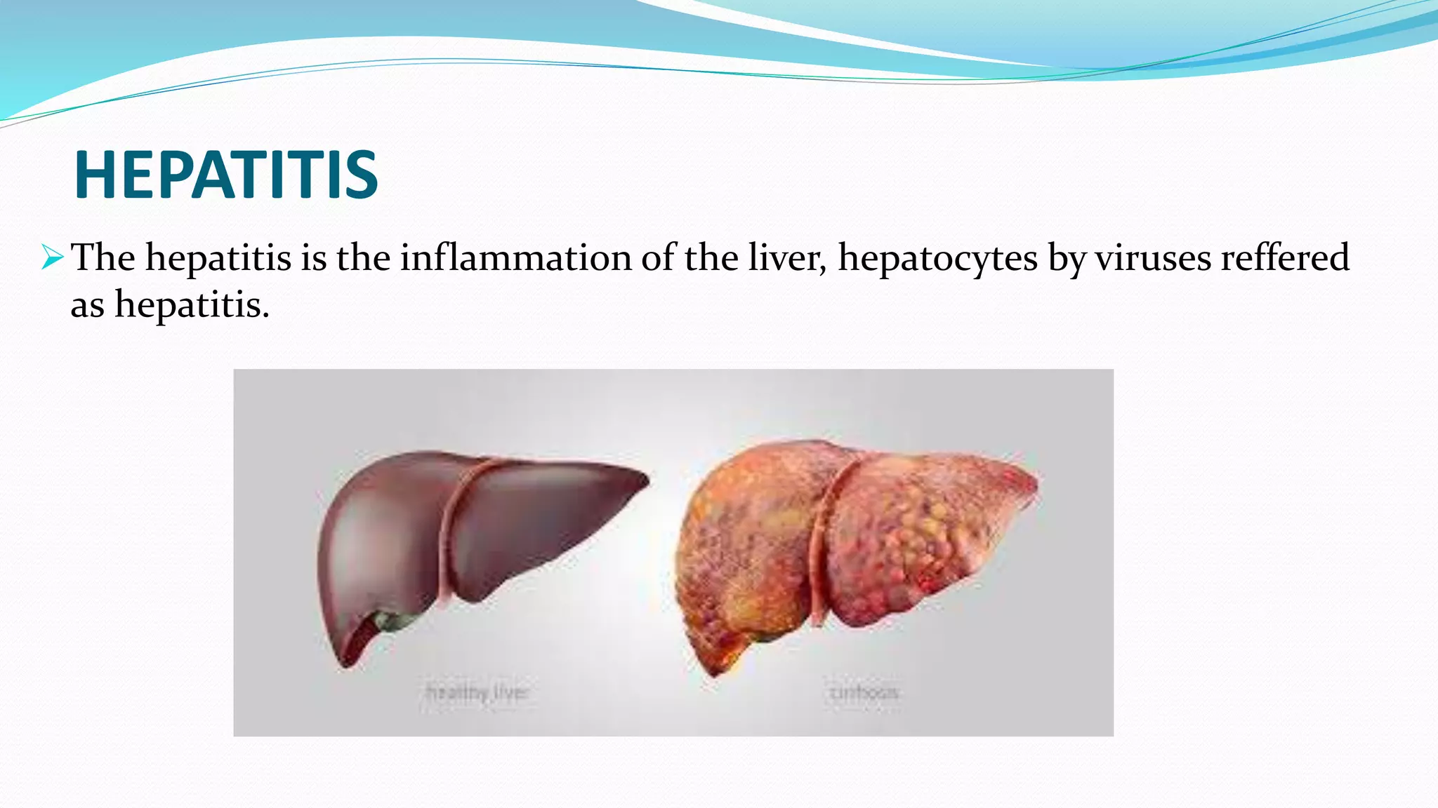 Hepatitis | PPTX