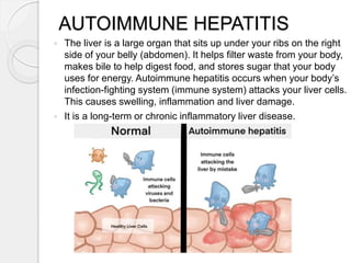 The Liver inflammation (hepatitis).pptx
