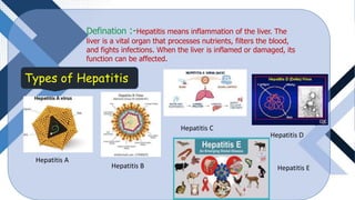 Infectious Disease(Hepatitis) it is a inflammatory disease | PPTX