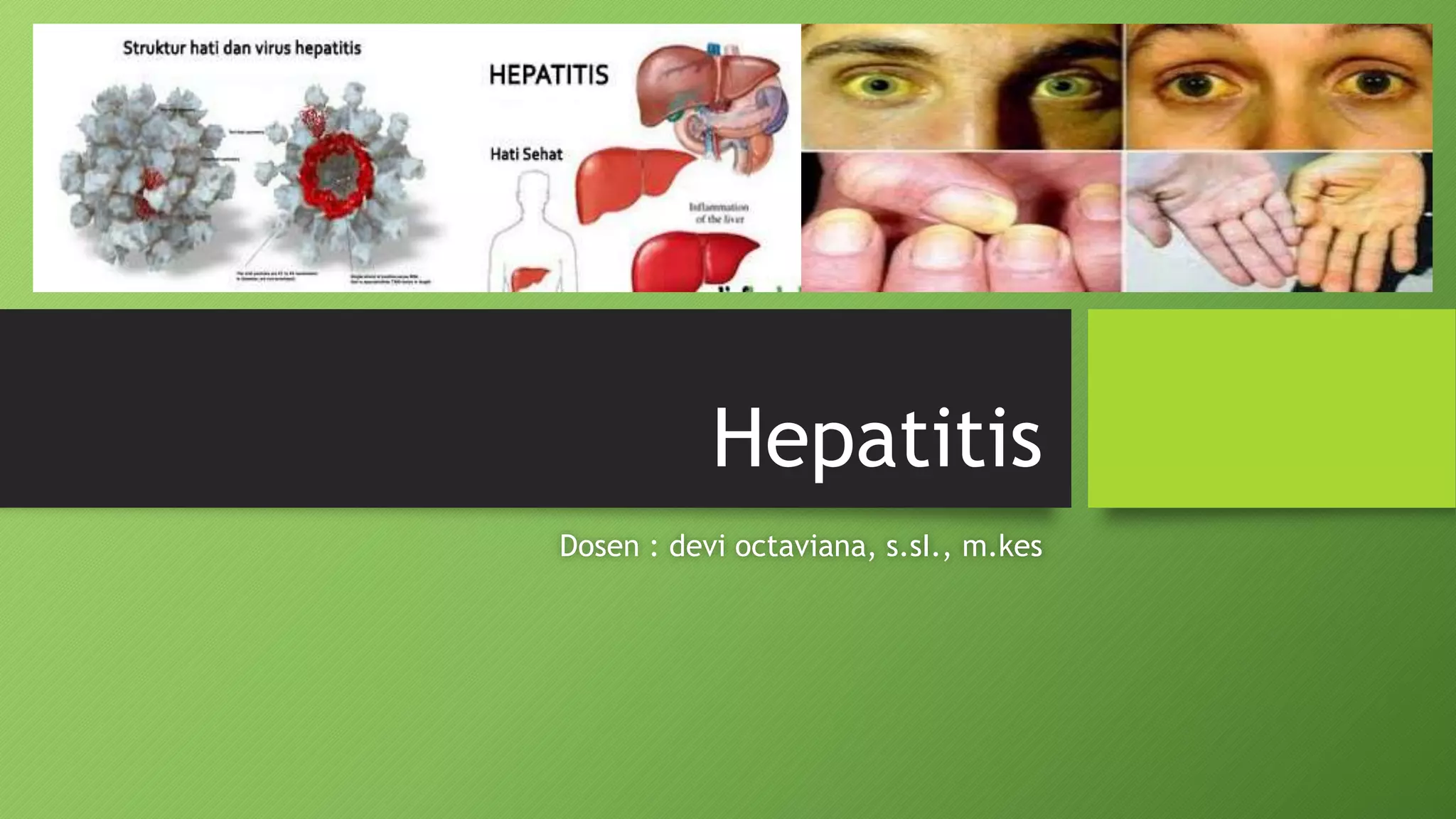 HEPATITIS 2022.pptx