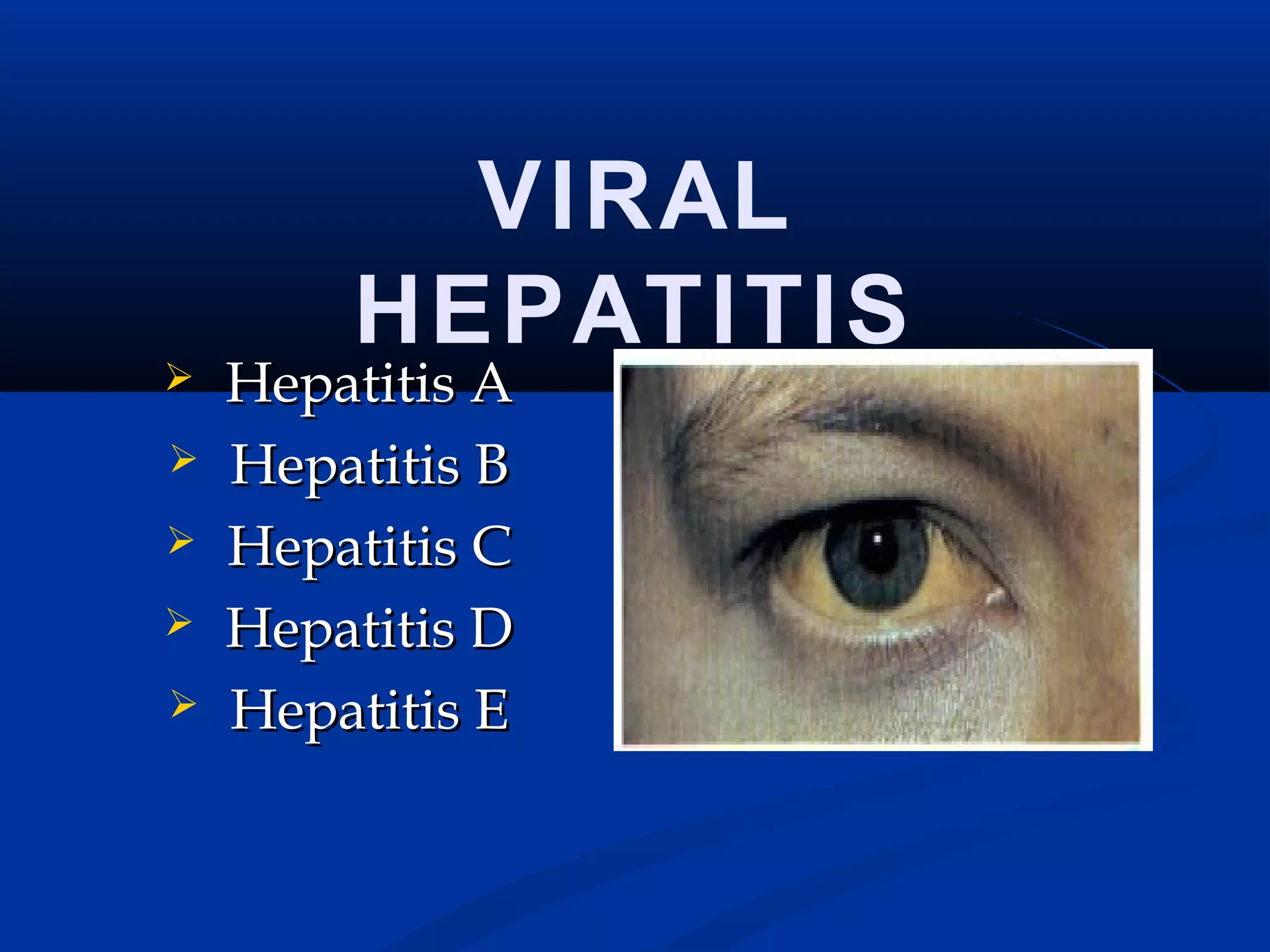 Hepatitis abcde.ppt