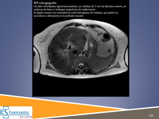 "Doctora estoy amarilla": Hepatitis autoinmune | PPT