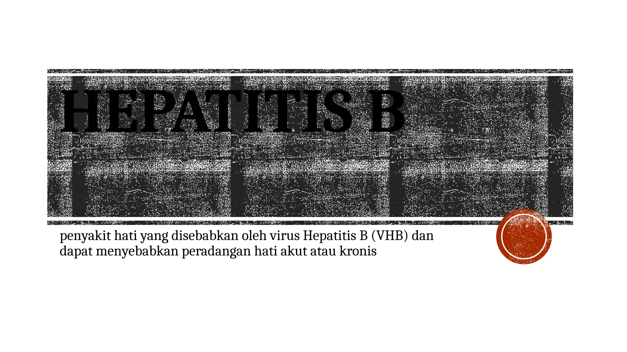 Hepatitis B penyakit hati yang disebabkan oleh virus Hepatitis B (VHB ...