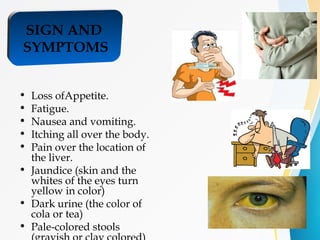 Hepatitis b (1) | PPT