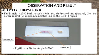 HEPATITIS B AND C PRESENTATION | PPTX