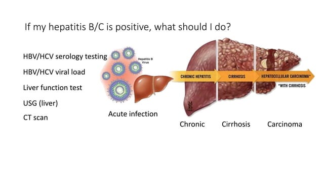 Basic info about Hepatitis B & C | PPT