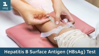 Hepatitis B Blood Test (HBsAg) | ODP