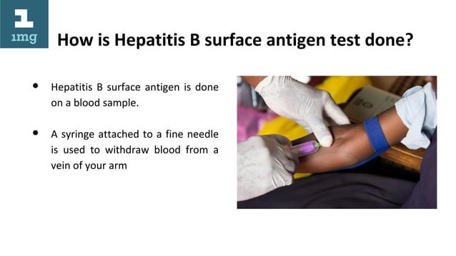 Hepatitis B Blood Test (HBsAg) | ODP
