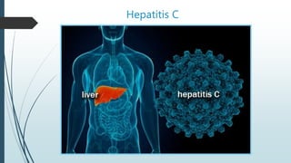 Hepatitis C | PPT
