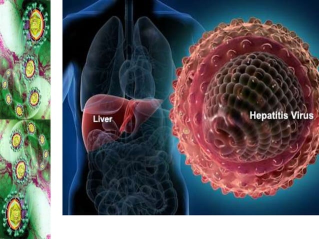 HEPATITIS C.ppt/ hepatitis/ hcv/ viruses | PPT