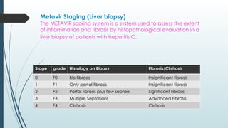 hepatitis c presentation on its management and treatment | PPTX