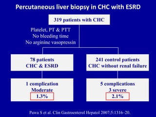 Hepatitis C virus & chronic kidney diseases | PPTX