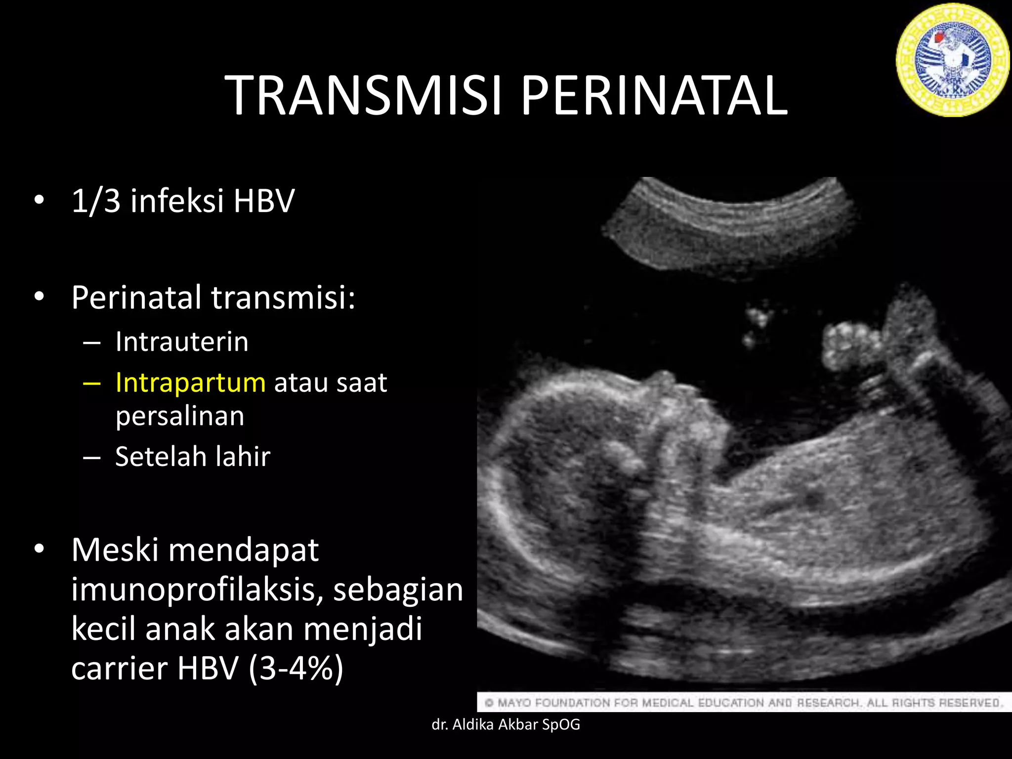 Hepatitis B dalam kehamilan | PPTX