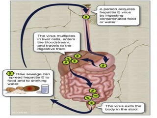 Hepatitis E infection | PPTX