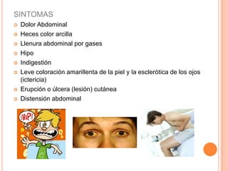 Hepatitis pancreatitis | PPTX