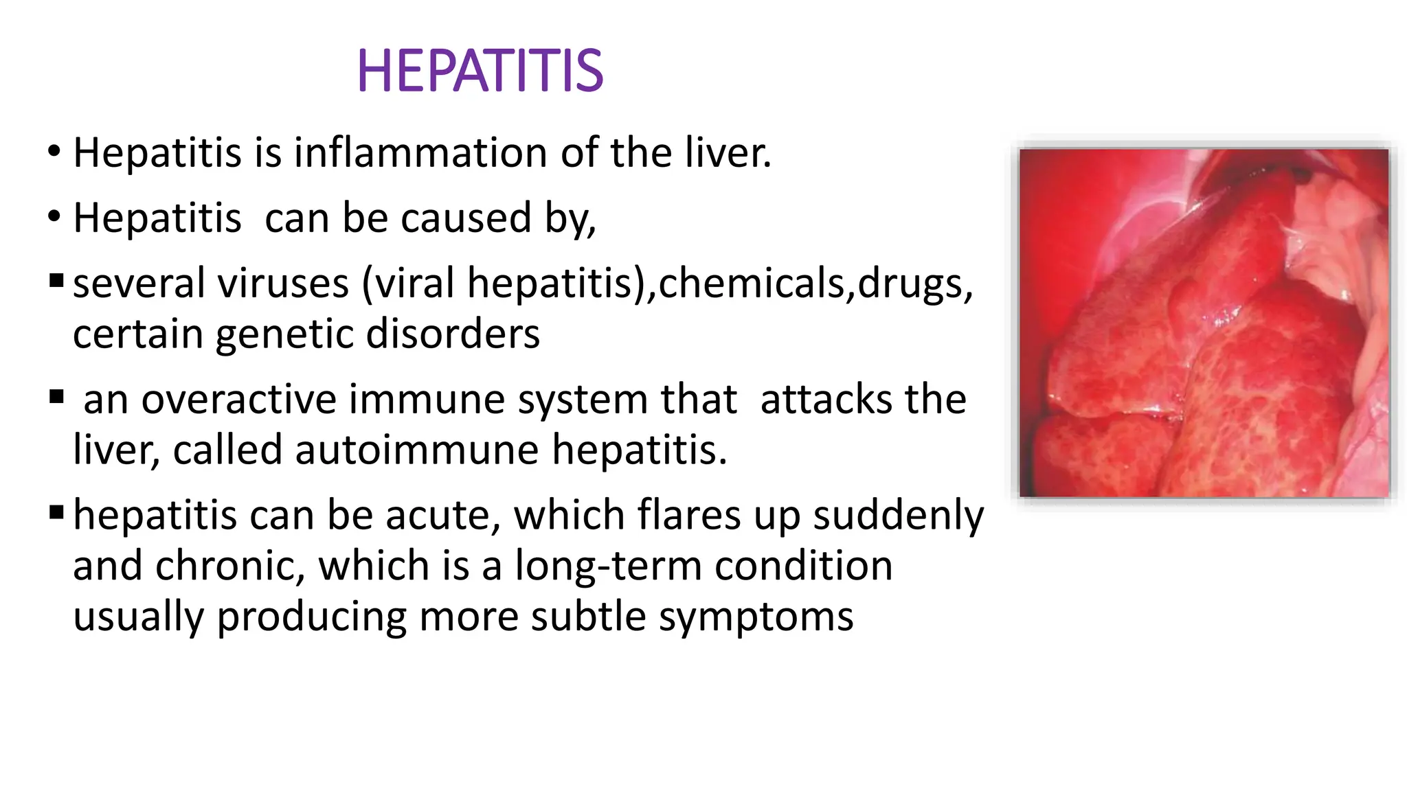 HEPATITIS PPT.pptx WITH GOOD EXPLANATION OF CHRONIC AS WELL AS ACUTE | PPTX