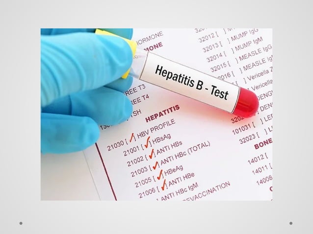 hepatitis ppt includes hepatitis in children- pathophysiology, signs ...