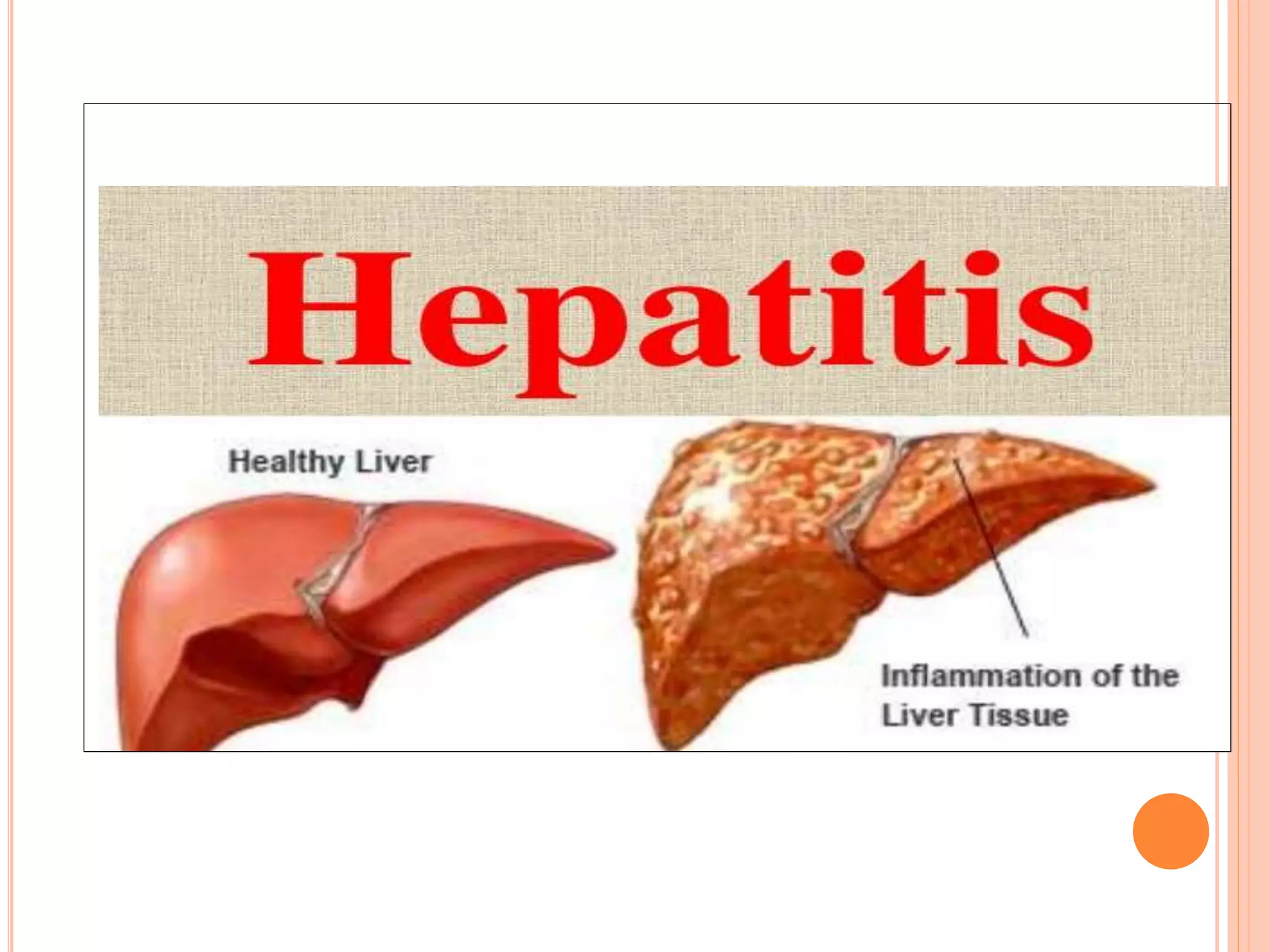 Hepatitis presentation | PPTX | Digestive Disorders | Diseases and ...