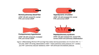HEPATO-RENAL SYNDROME , HEPATO-PULMONARY SYNDROME & PORTAL HYPERTENSION ...