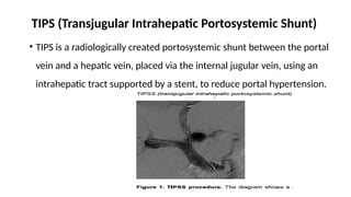HEPATO-RENAL SYNDROME , HEPATO-PULMONARY SYNDROME & PORTAL HYPERTENSION ...