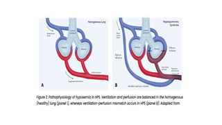 HEPATO-RENAL SYNDROME , HEPATO-PULMONARY SYNDROME & PORTAL HYPERTENSION ...