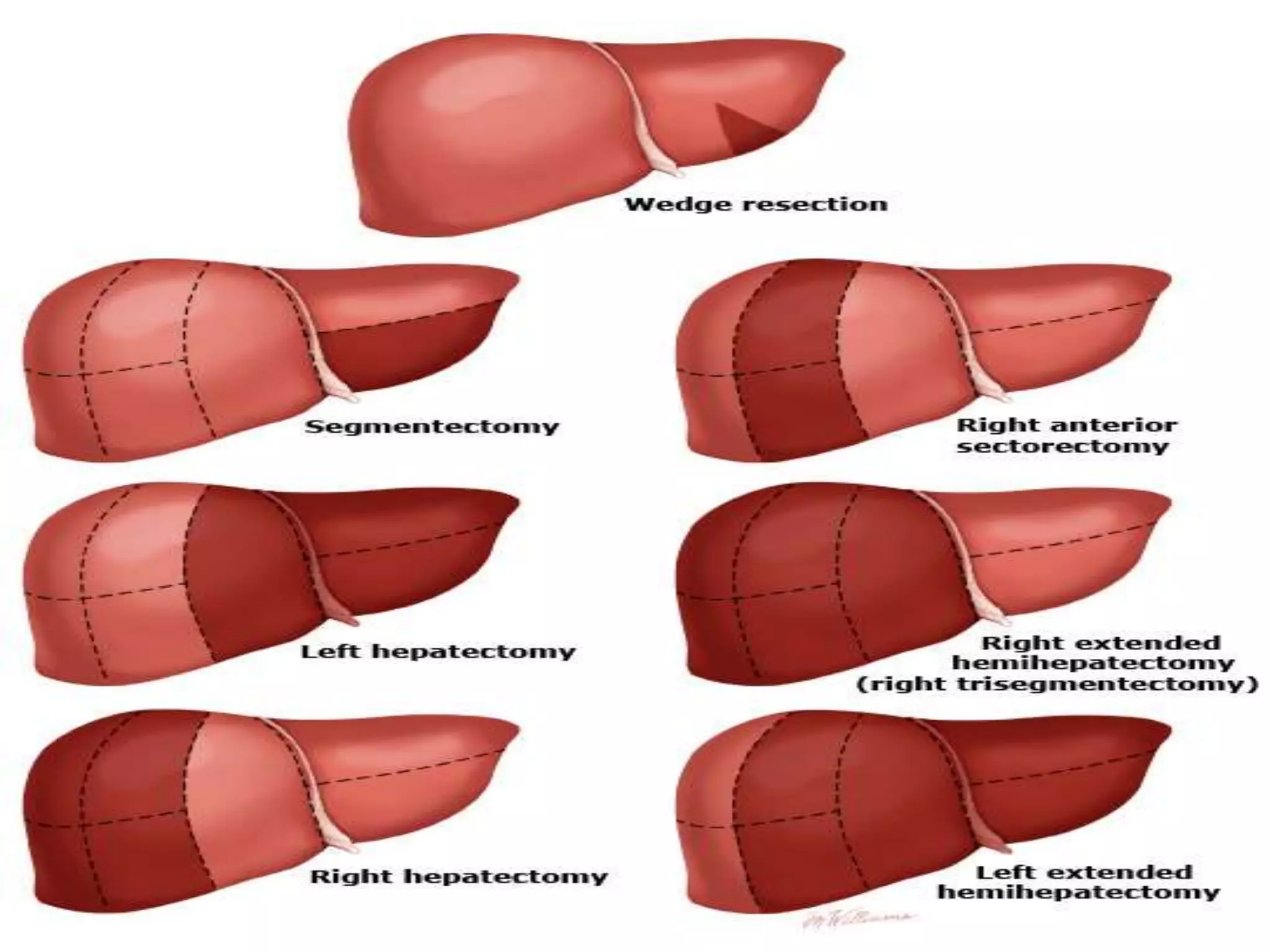 Hepatobiliary anatomy | PPTX