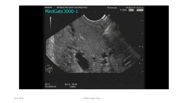 Hepatobiliary eus apasl | PPTX | Digestive Disorders | Diseases and ...
