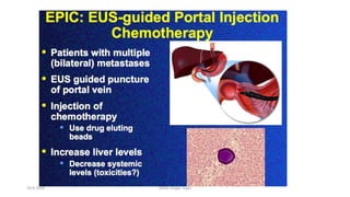 Hepatobiliary eus apasl | PPTX | Digestive Disorders | Diseases and ...