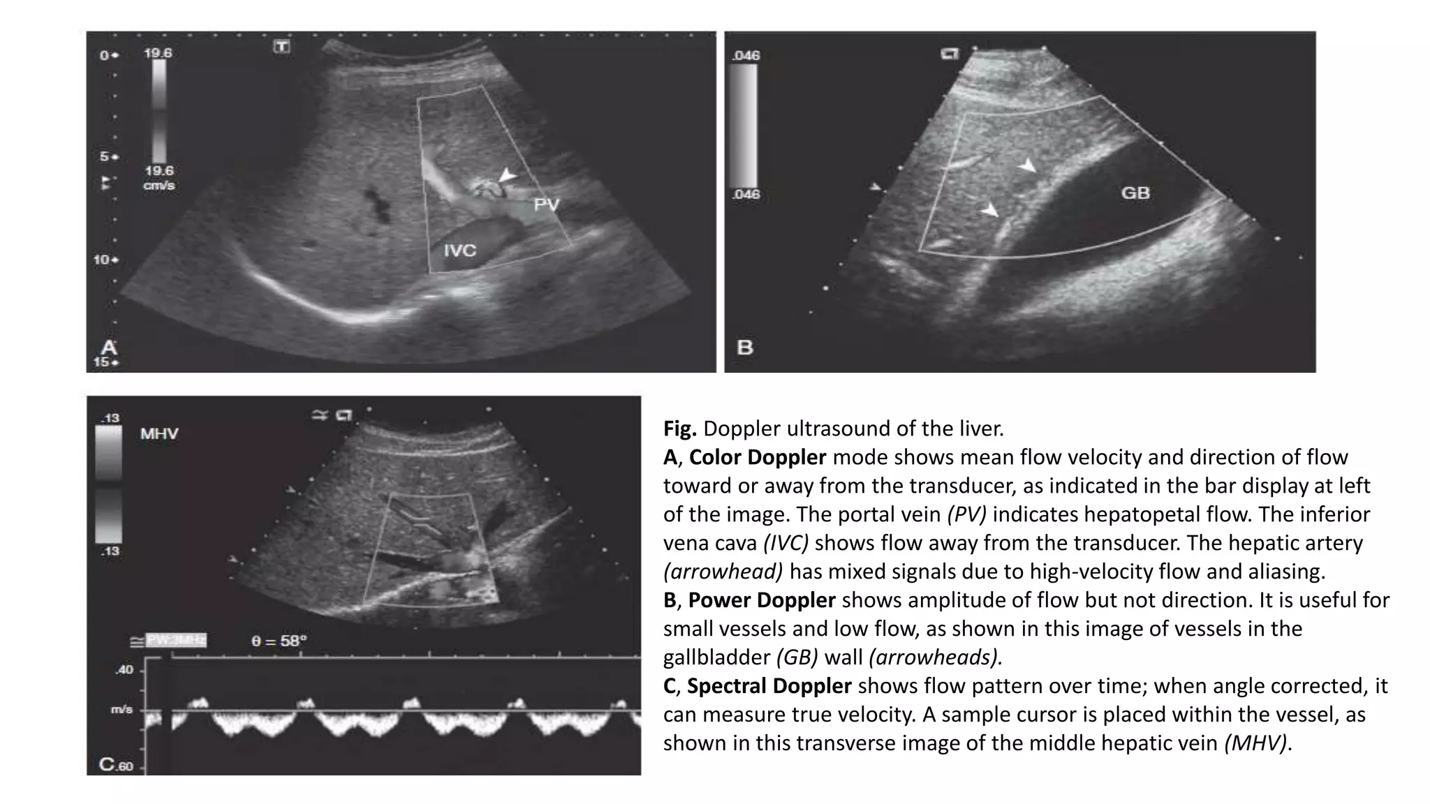 Hepatobiliary Imaging.pptx
