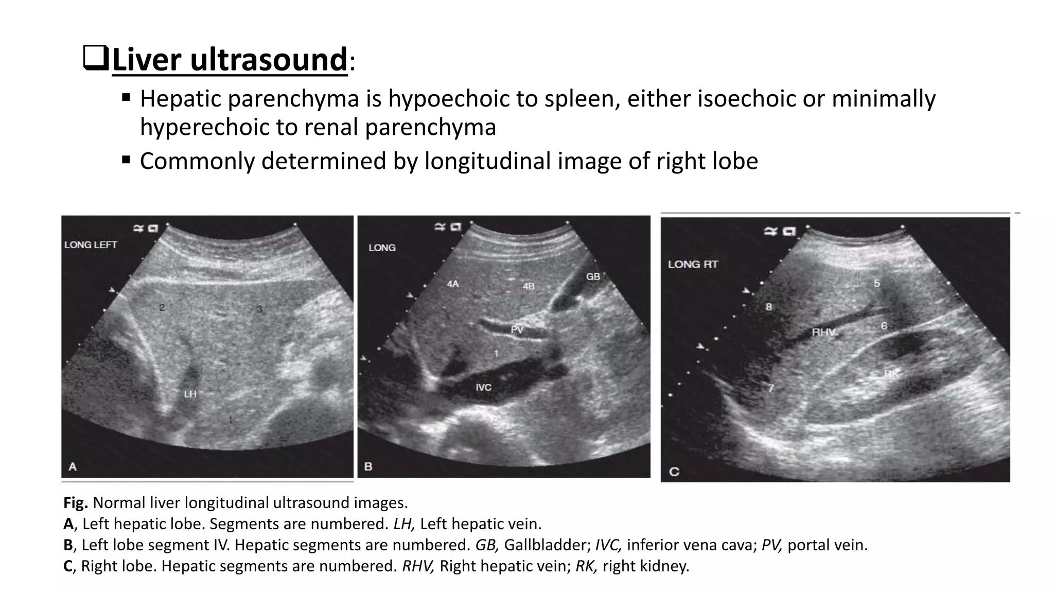 Hepatobiliary Imaging.pptx