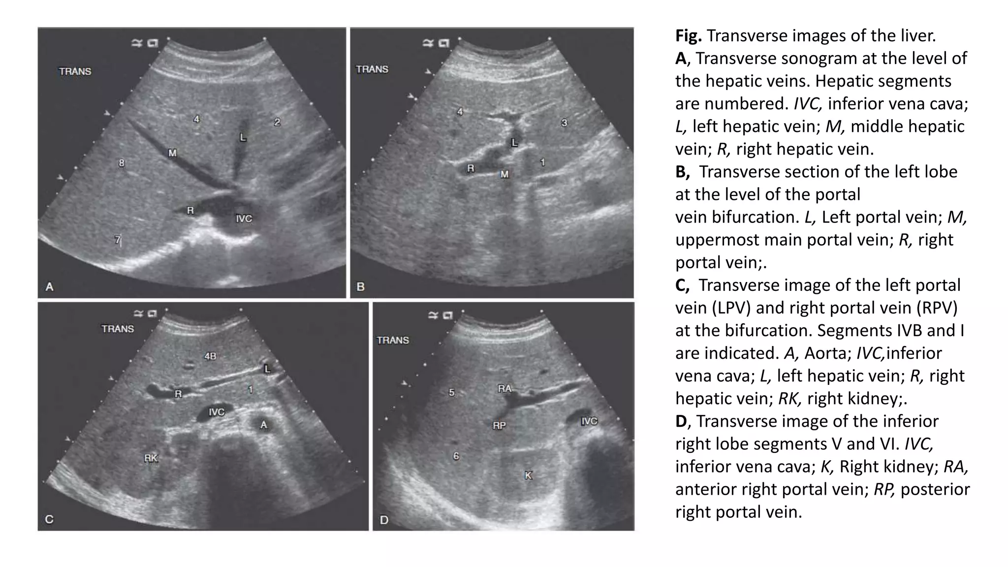 Hepatobiliary Imaging.pptx