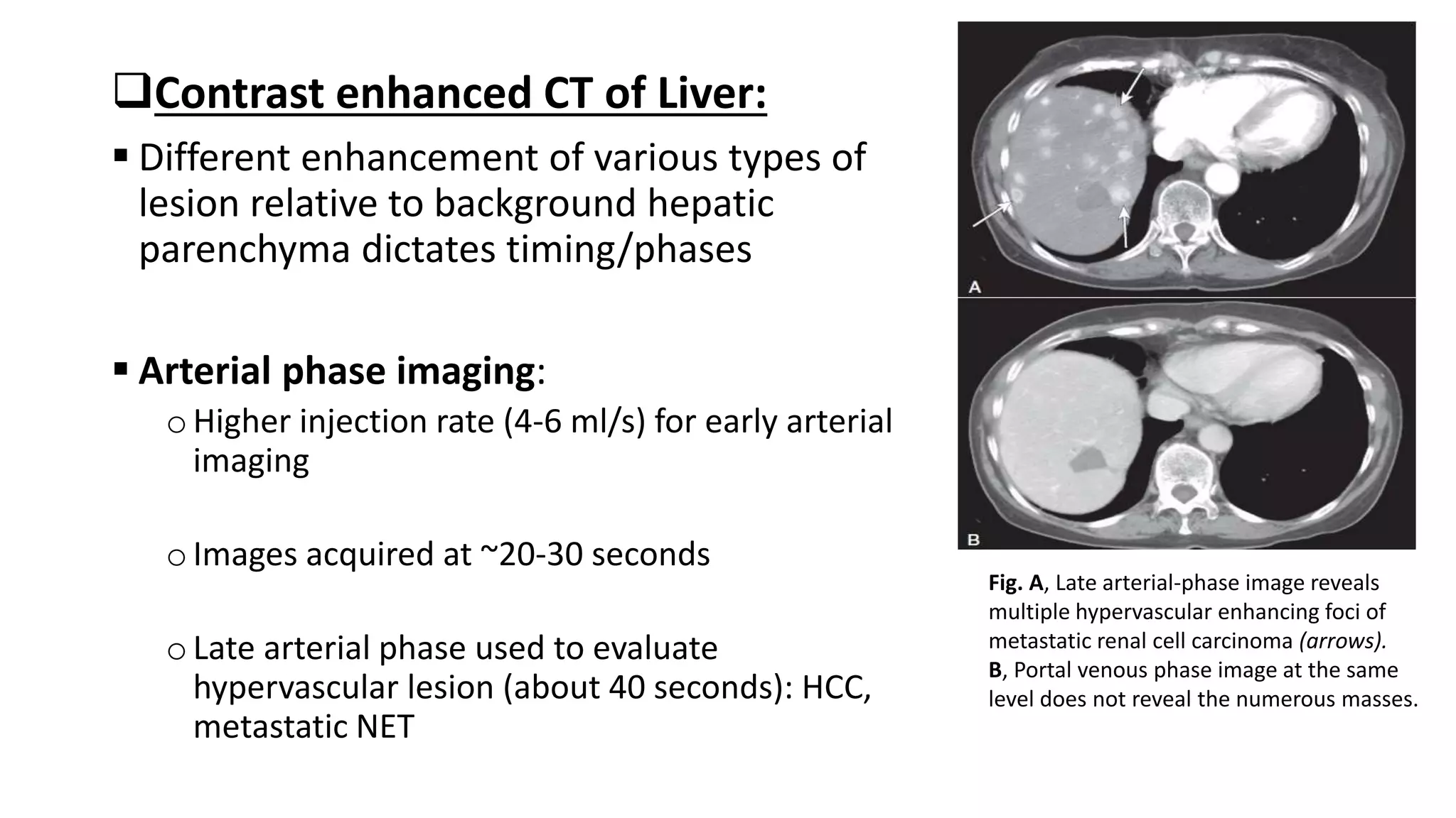 Hepatobiliary Imaging.pptx