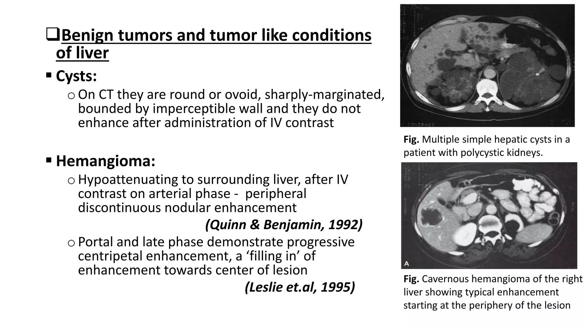 Hepatobiliary Imaging.pptx