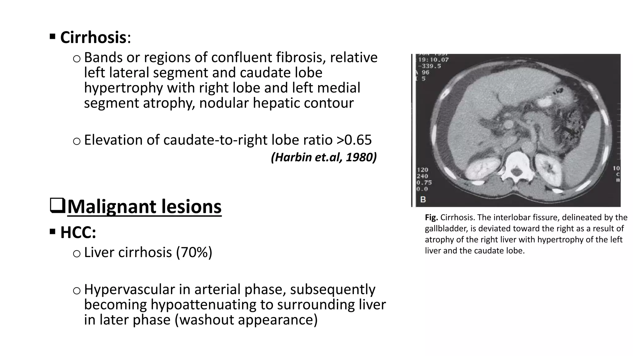 Hepatobiliary Imaging.pptx