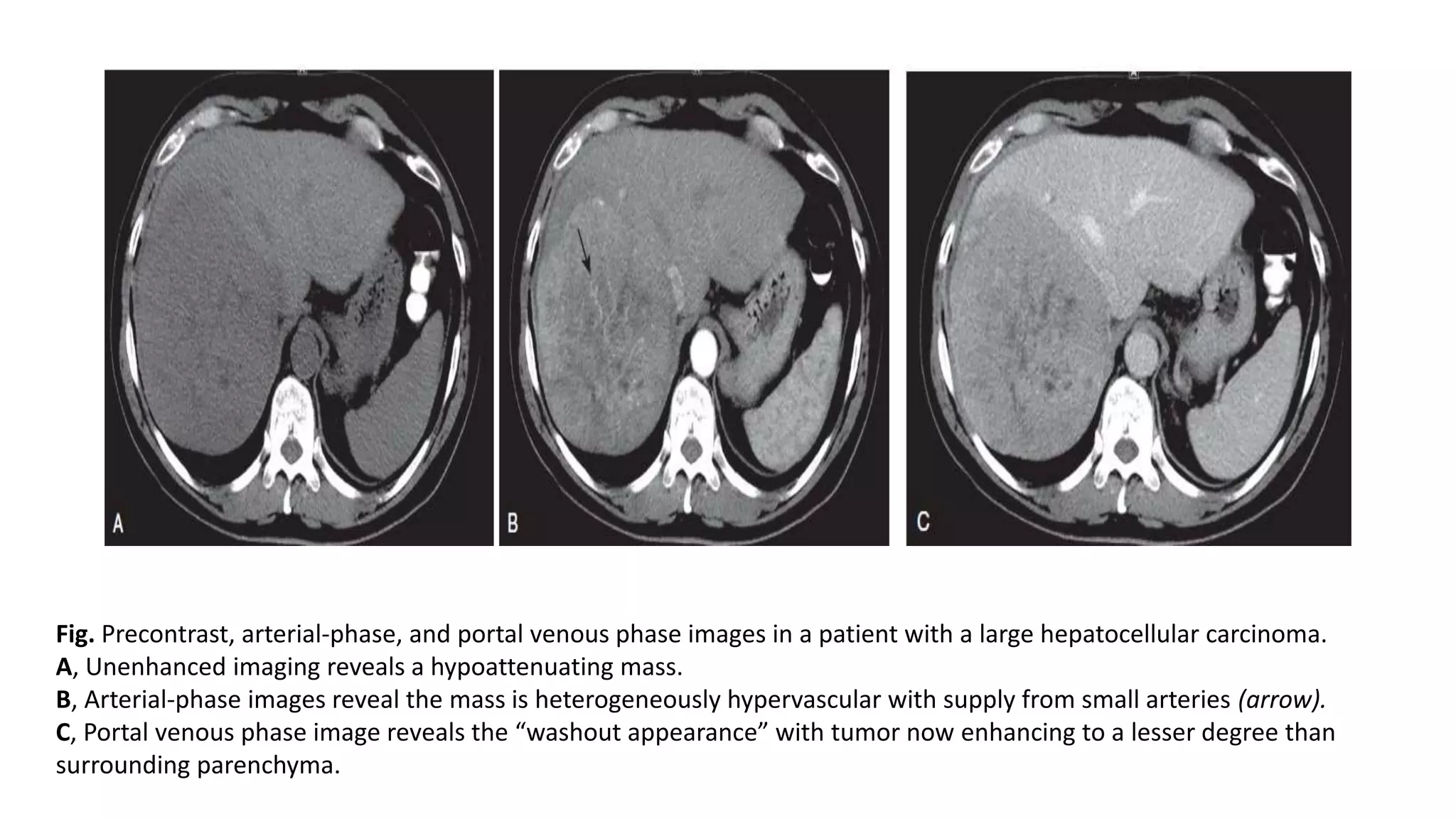 Hepatobiliary Imaging.pptx