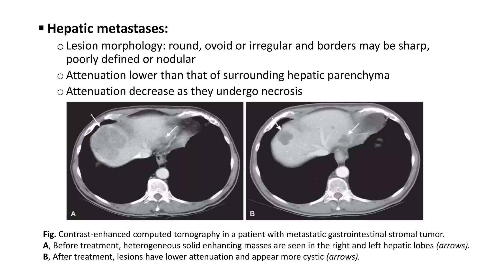 Hepatobiliary Imaging.pptx
