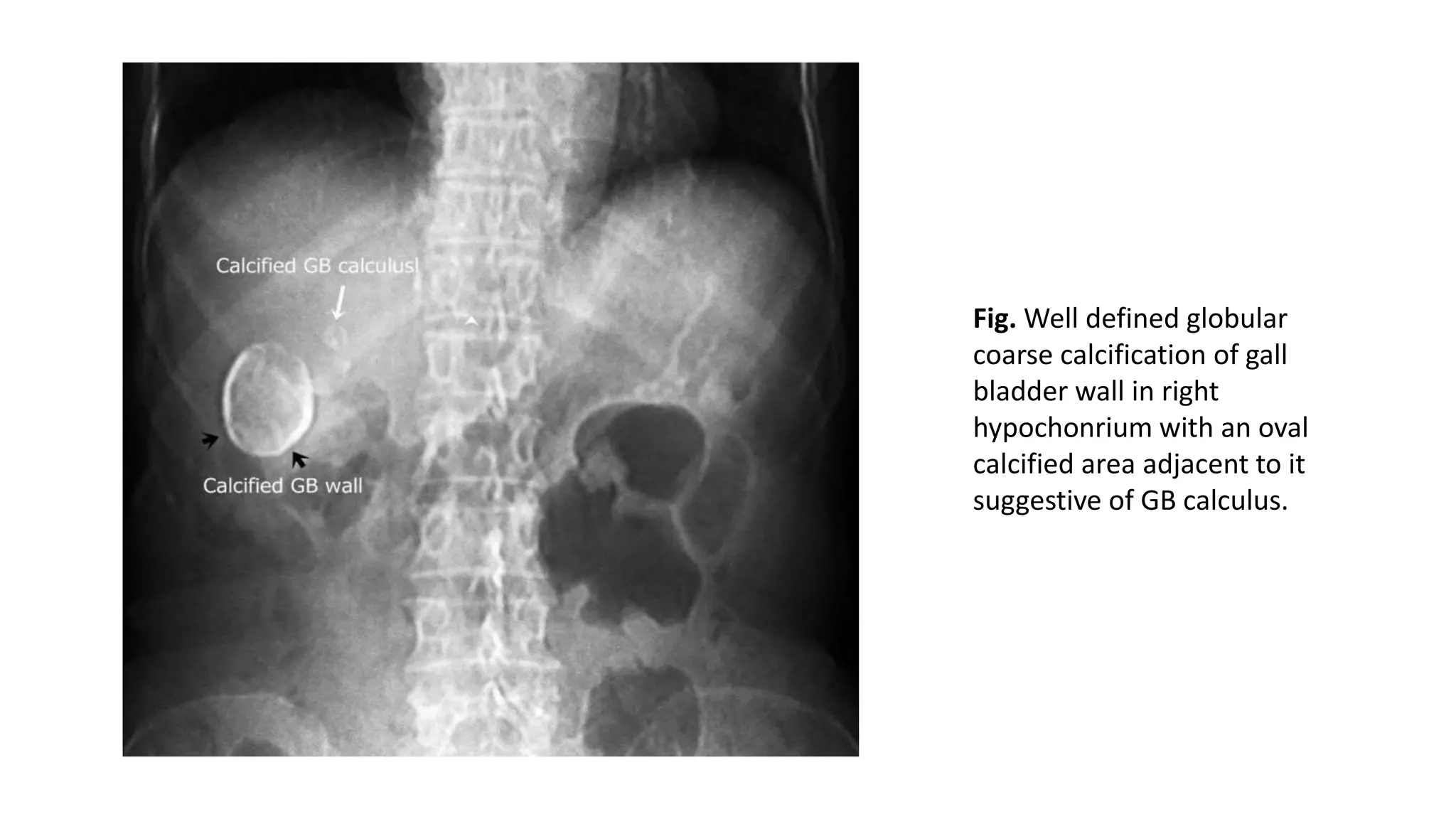 Hepatobiliary Imaging.pptx