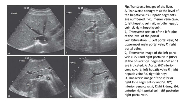 Hepatobiliary Imaging.pptx