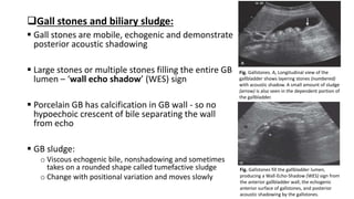 Hepatobiliary Imaging.pptx