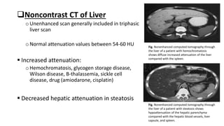 Hepatobiliary Imaging.pptx