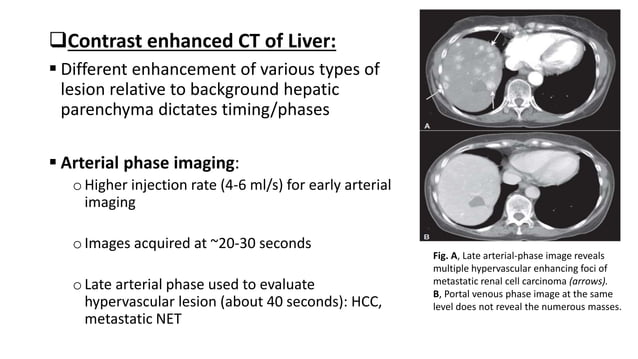 Hepatobiliary Imaging.pptx