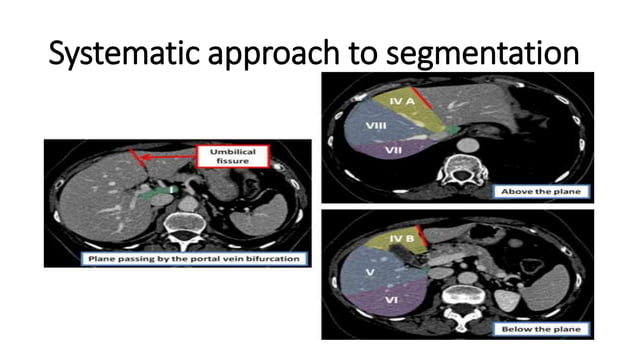 Hepatobiliary Imaging Pptx
