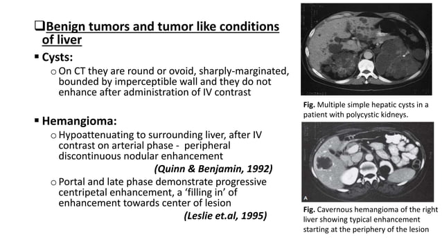 Hepatobiliary Imaging.pptx