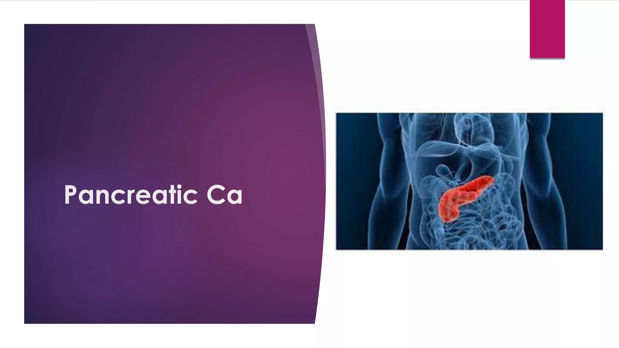 Hepatobiliary pancreatic ca | PPTX