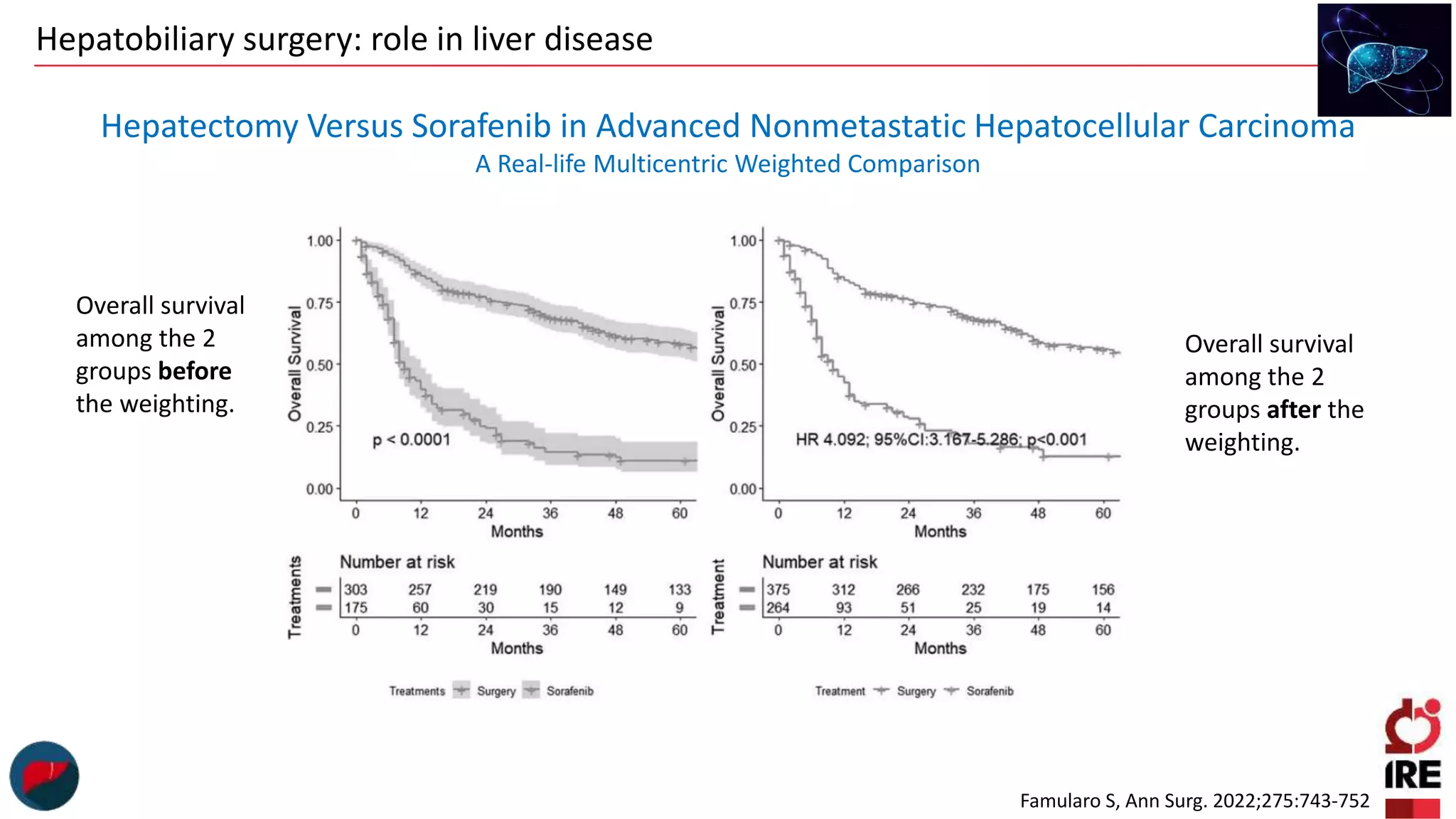 Hepatobiliary surgery - role in liver diseases.pptx