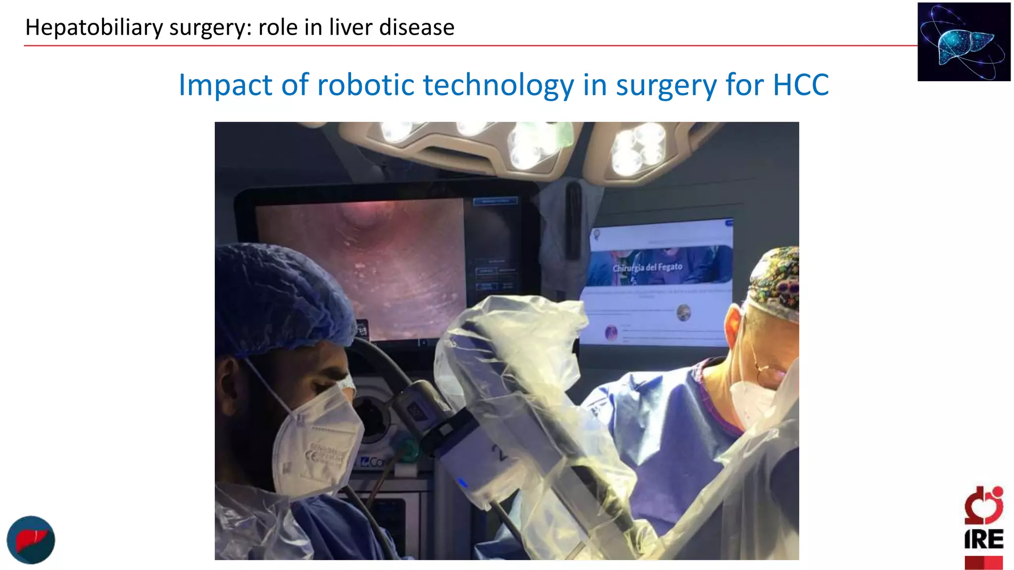 Hepatobiliary surgery - role in liver diseases.pptx