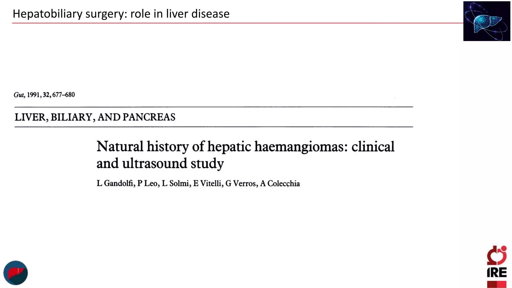 Hepatobiliary surgery - role in liver diseases.pptx