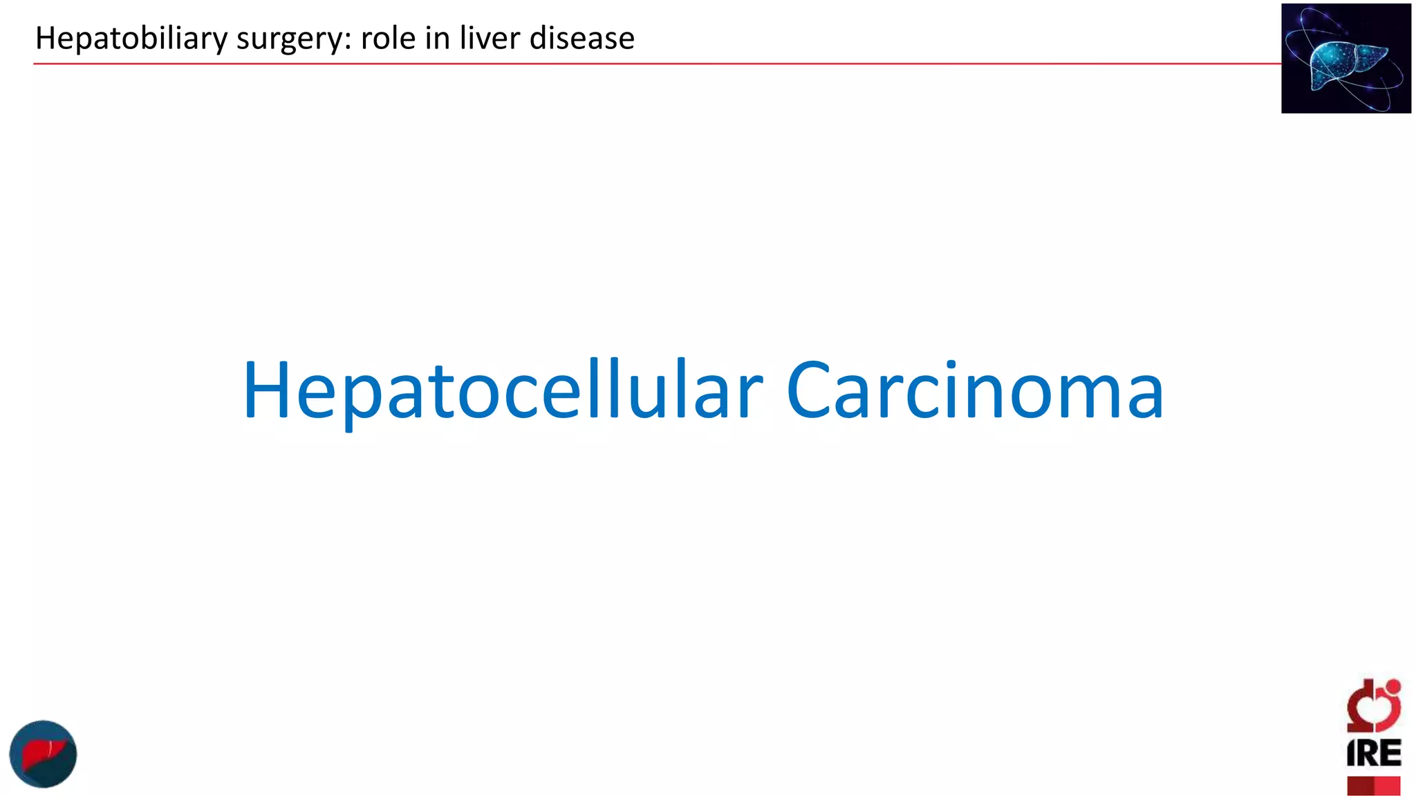 Hepatobiliary surgery - role in liver diseases.pptx